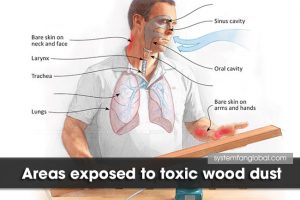 What is wood dust? How is wood dust harmful to human health?